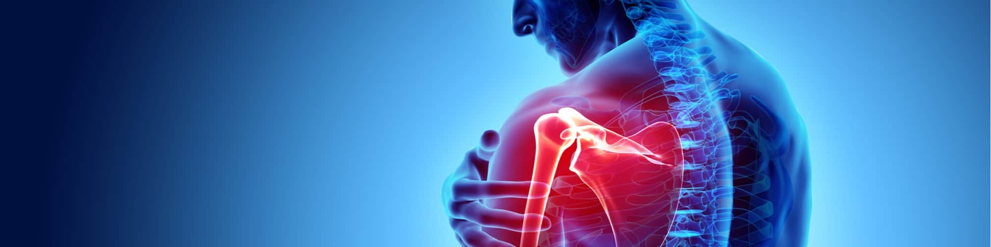 Tendonitis Treatment | OrthoUnited