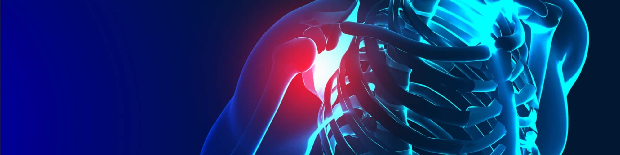 Shoulder Injuries We Treat | OrthoUnited