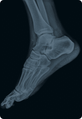 Most Advanced Orthopaedic Care in NE Ohio | OrthoUnited
