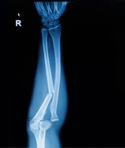 Area’s Leading Orthopaedic Trauma Care | OrthoUnited
